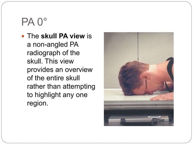 Skull anatomy and positioning | PPTX