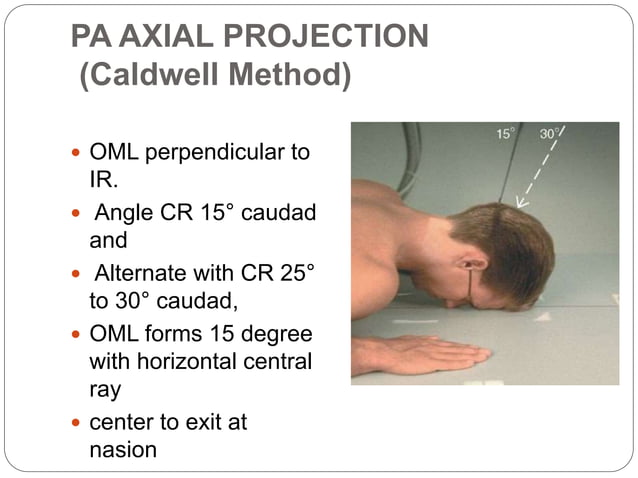 Skull anatomy and positioning | PPTX