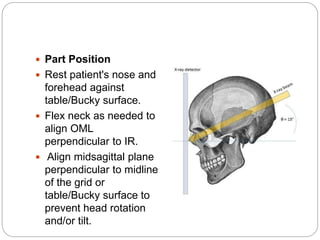 Skull anatomy and positioning | PPTX