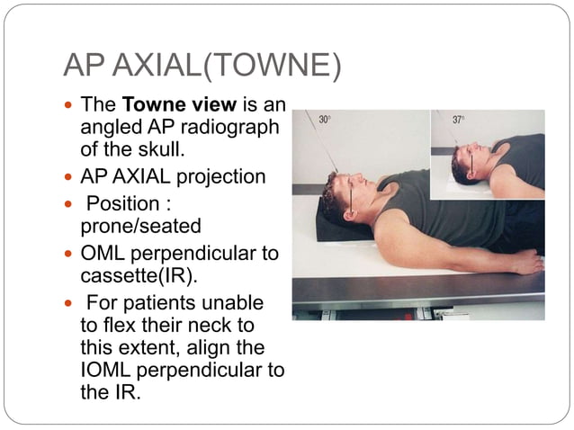 Skull anatomy and positioning | PPTX
