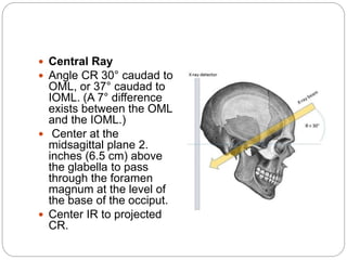 Skull anatomy and positioning | PPTX
