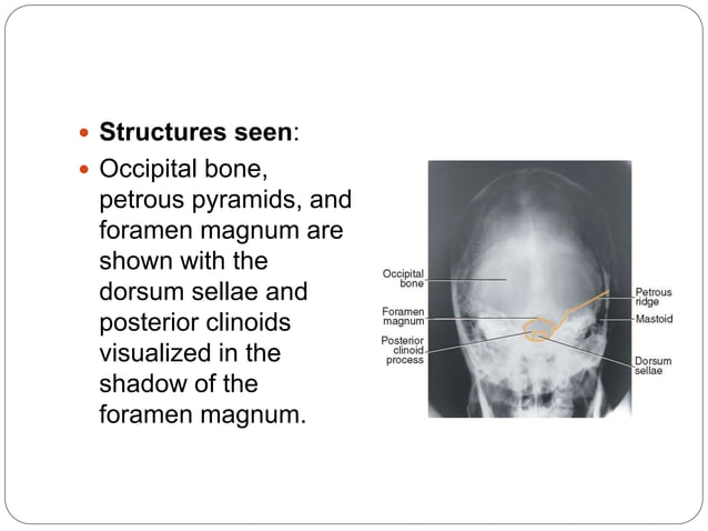 Skull anatomy and positioning | PPTX