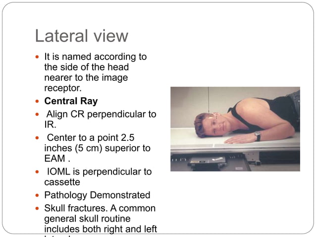 Skull anatomy and positioning | PPTX