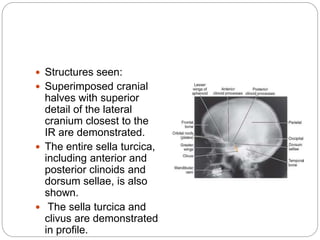 Skull anatomy and positioning | PPTX