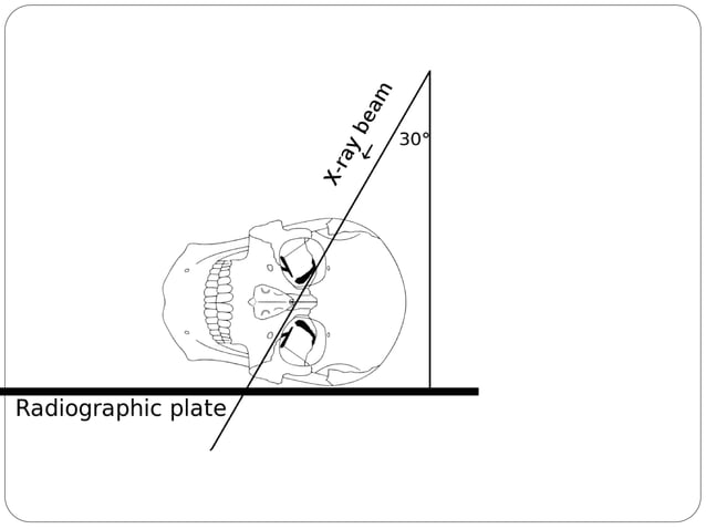 Skull anatomy and positioning | PPTX