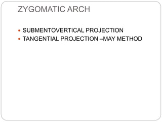Submentovertical Zygomatic Arches