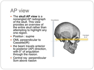 Skull anatomy and positioning | PPT