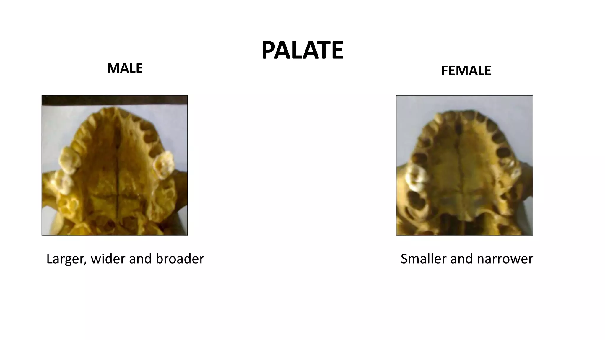 Skull and Mandible (2).pptx