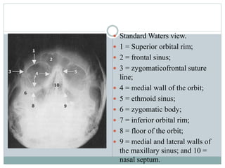 Skull and maxillofacial radiography | PPTX