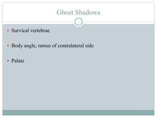 Skull and maxillofacial radiography | PPTX