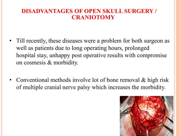 Endoscopic SKULL BASE surgery | PPTX