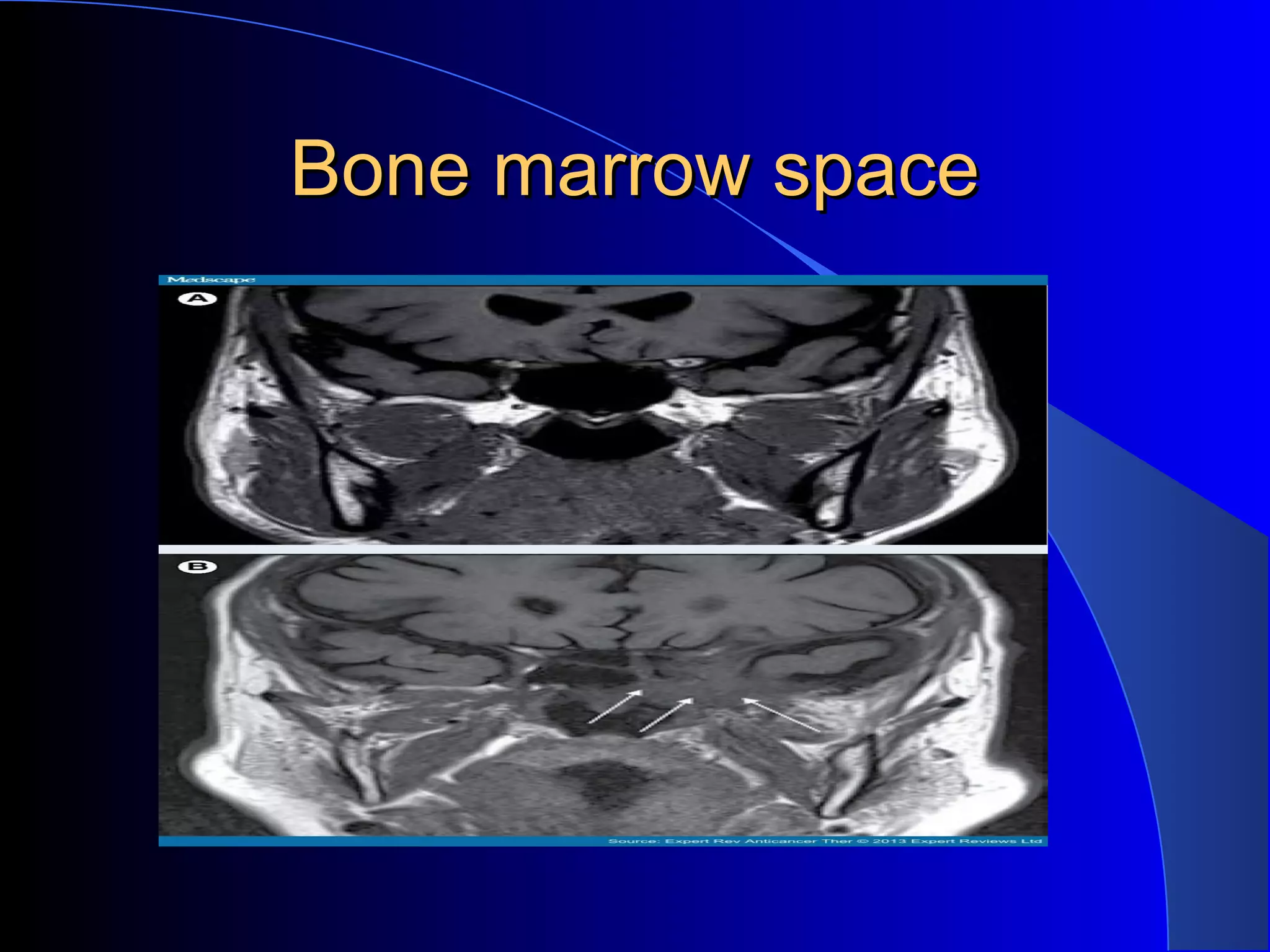 SKULL BASE IMAGING | PPT
