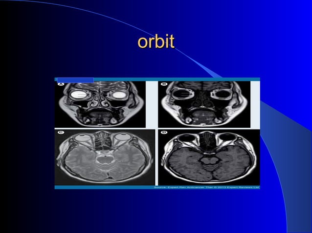 SKULL BASE IMAGING | PPT | Bone and Joint Conditions | Diseases and ...