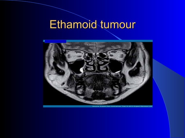 SKULL BASE IMAGING | PPT | Bone and Joint Conditions | Diseases and ...