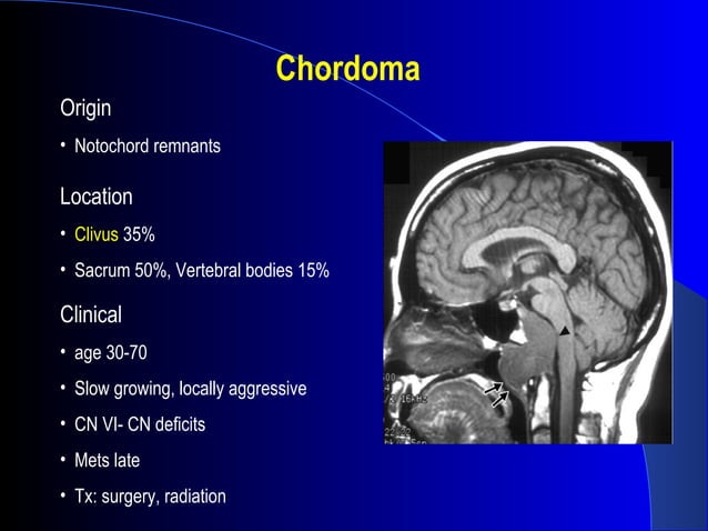 SKULL BASE IMAGING | PPT | Bone and Joint Conditions | Diseases and ...