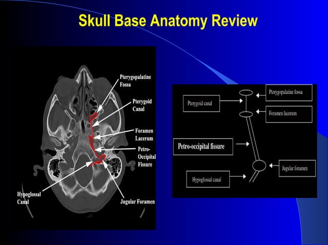 SKULL BASE IMAGING | PPT | Bone and Joint Conditions | Diseases and ...