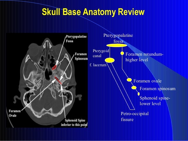 SKULL BASE IMAGING