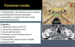 Foramen Ovale Skull Base