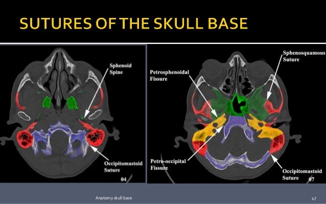 Skull base : Development and anatomy.
