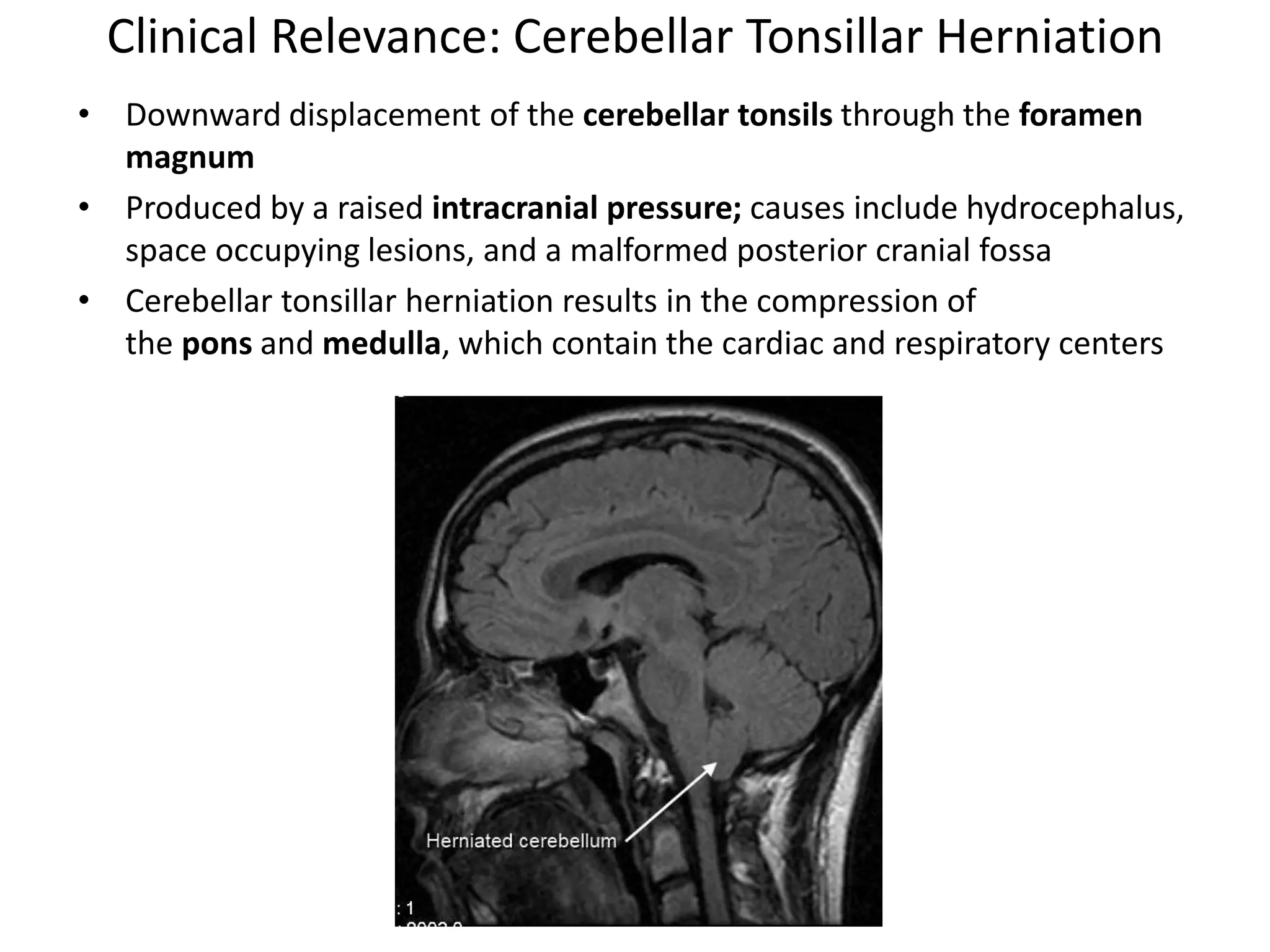 Skull base anatomy.pptx