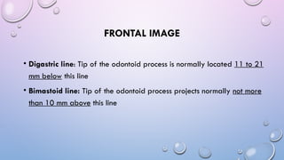 Radiological Anatomy of the Skull Base by Dr. Aryan | PPTX