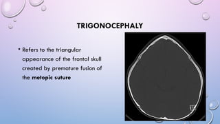 Radiological Anatomy of the Skull Base by Dr. Aryan | PPTX