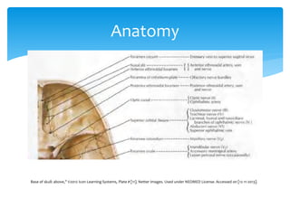 Skull Base fractures ( PDFDrive ).pdf