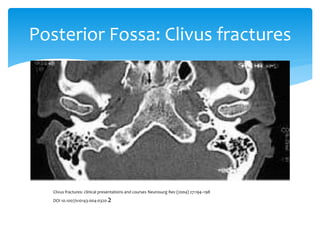 Skull Base fractures ( PDFDrive ).pdf