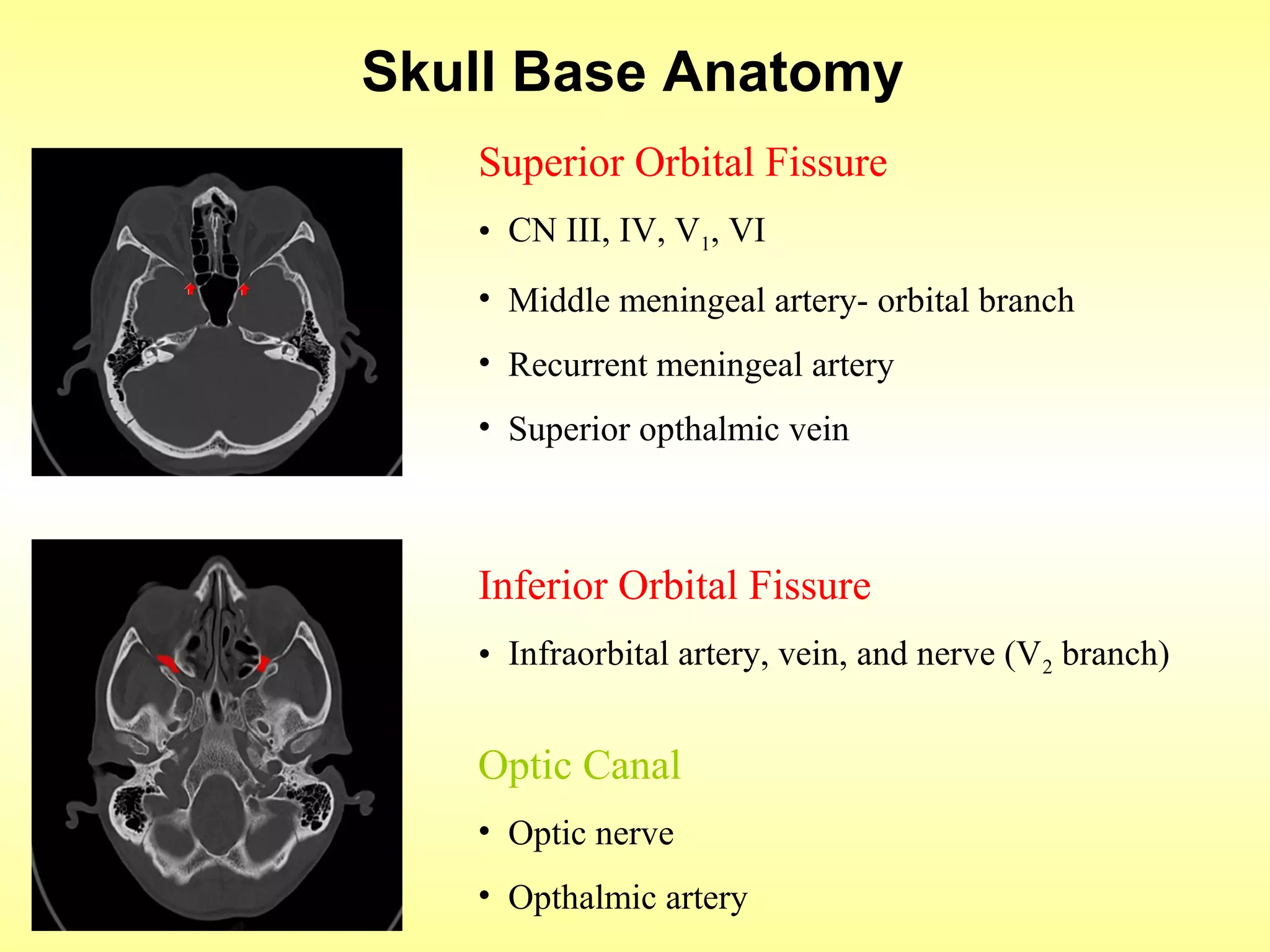 Skull base imaging | PPT