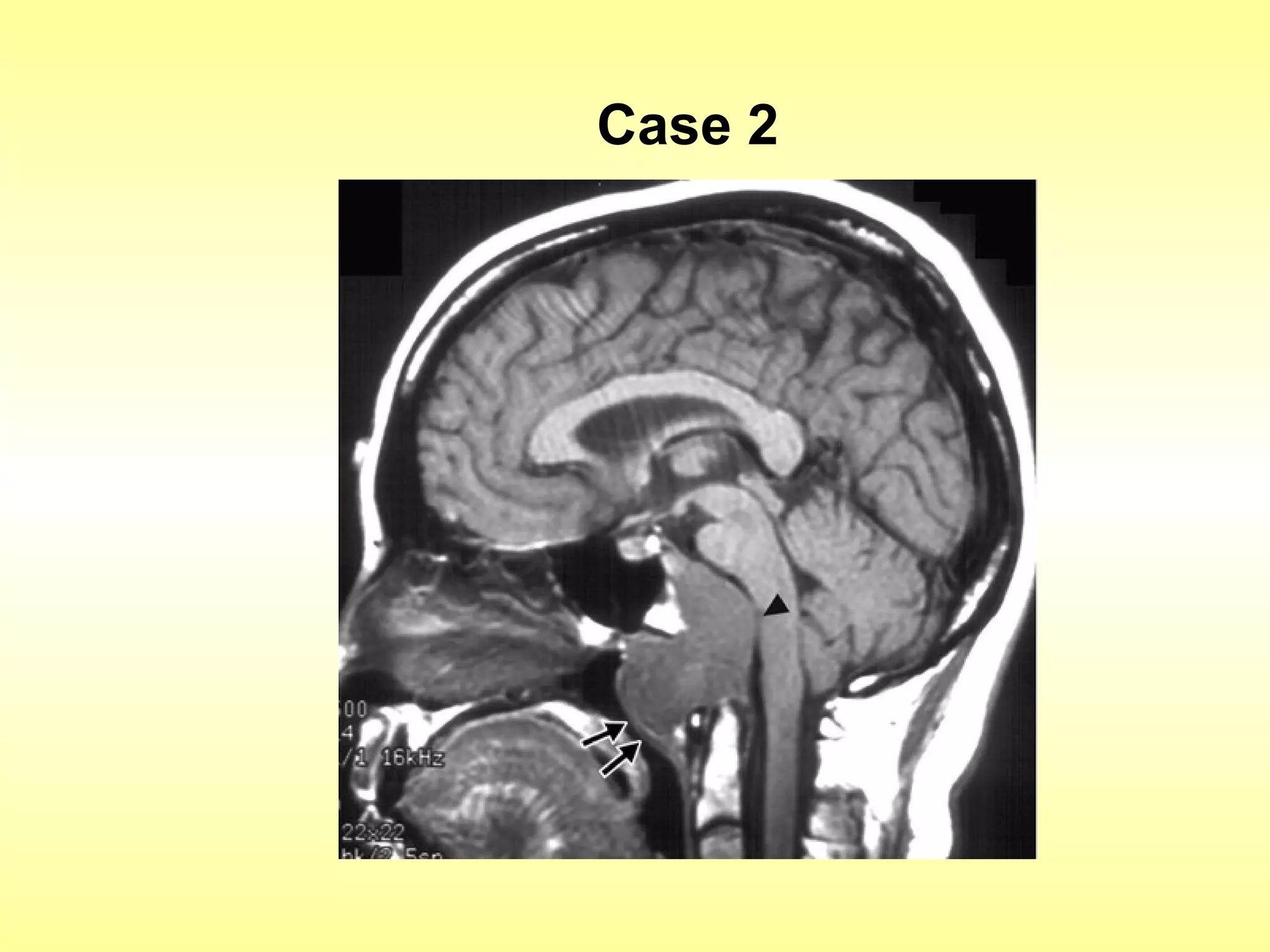 Skull base imaging | PPT