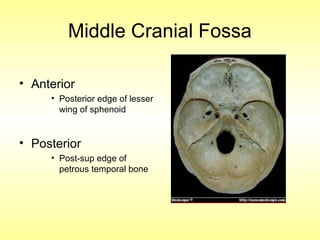 Skull base imaging | PPT