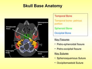 Skull base imaging | PPT
