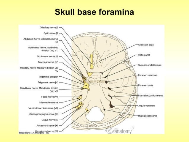 Skull base imaging | PPT | Ear, Nose and Throat Conditions | Diseases ...