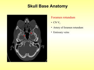 Skull base imaging | PPT