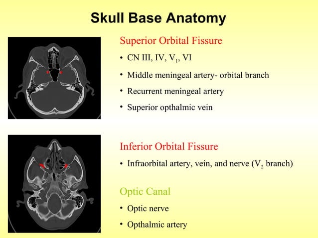 Skull base imaging | PPT | Ear, Nose and Throat Conditions | Diseases and Conditions