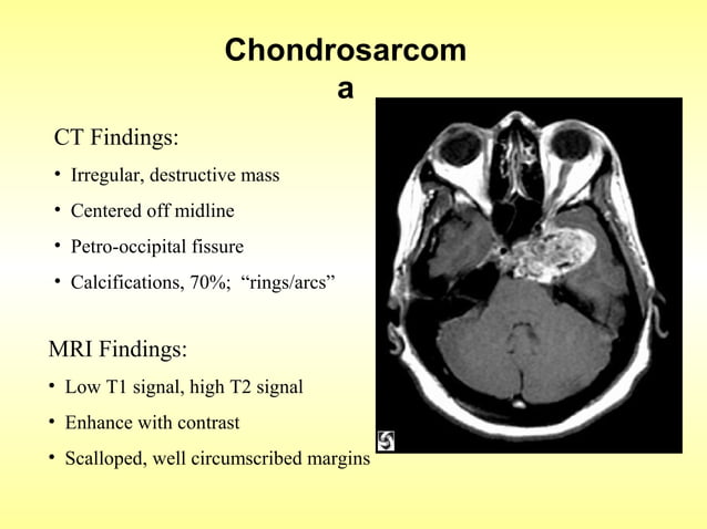 Skull base imaging | PPT | Ear, Nose and Throat Conditions | Diseases ...