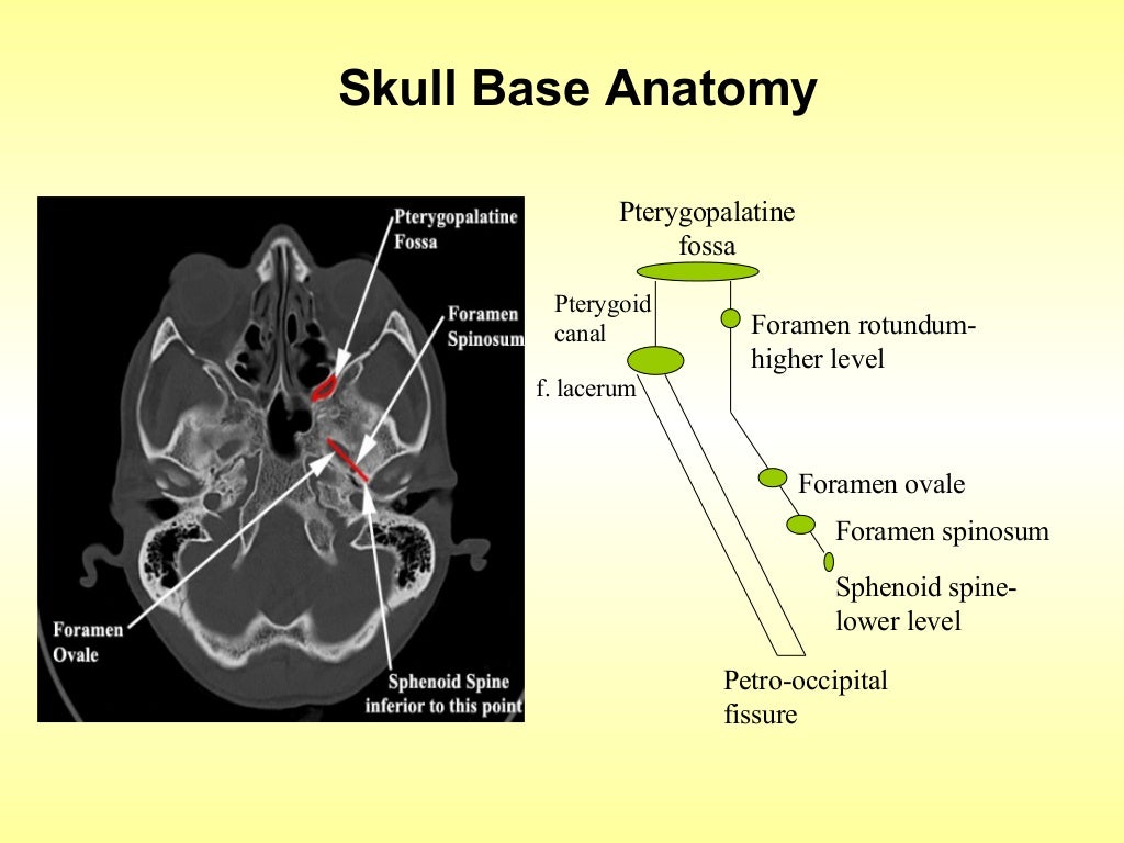 Skull base imaging