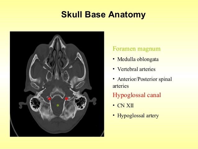 Skull base imaging