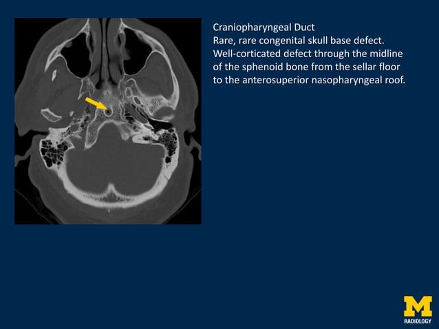 skullbase imaging.pptx | Ear, Nose and Throat Conditions | Diseases and ...