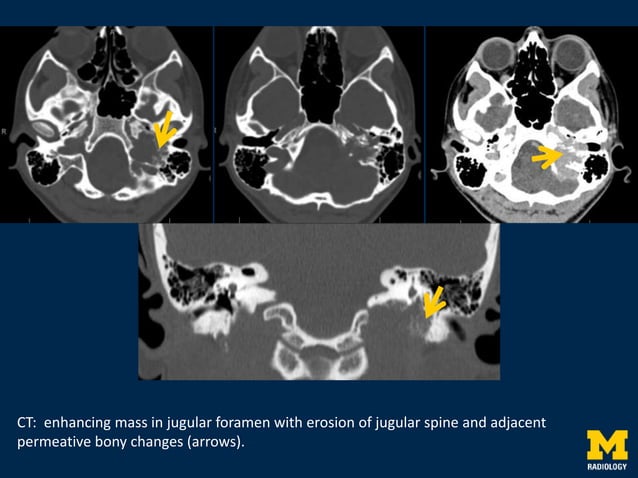 skullbase imaging.pptx | Ear, Nose and Throat Conditions | Diseases and ...