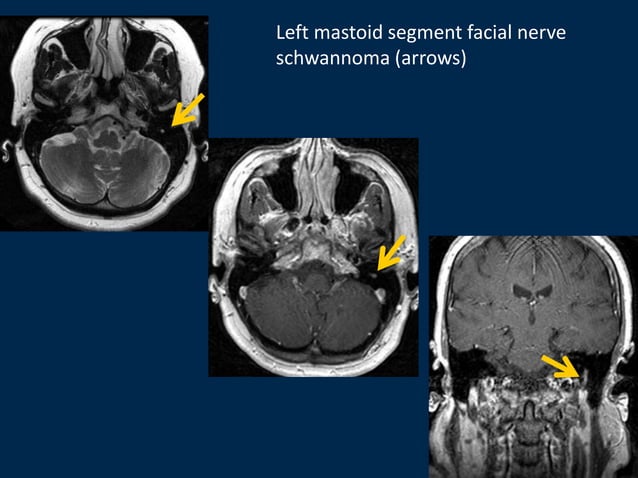 skullbase imaging.pptx | Ear, Nose and Throat Conditions | Diseases and ...