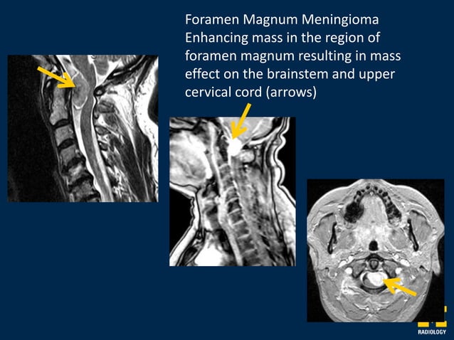 skullbase imaging.pptx | Ear, Nose and Throat Conditions | Diseases and ...