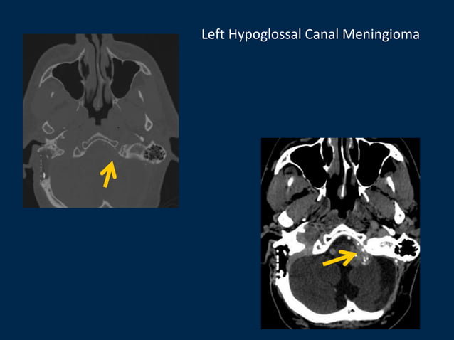 skullbase imaging.pptx | Ear, Nose and Throat Conditions | Diseases and ...