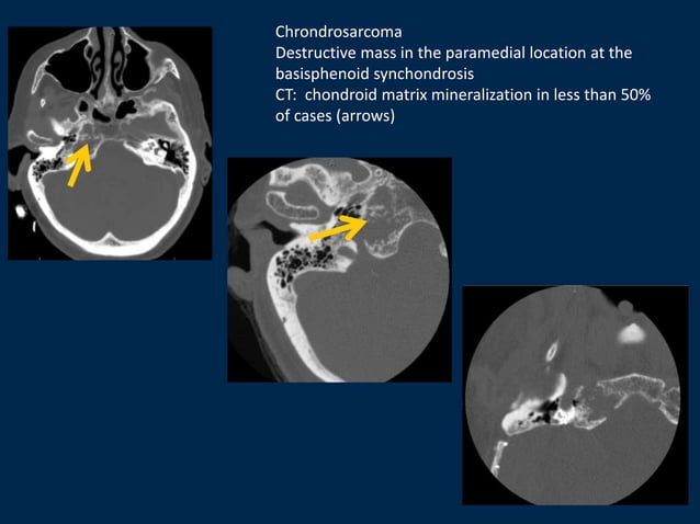 skullbase imaging.pptx | Ear, Nose and Throat Conditions | Diseases and ...