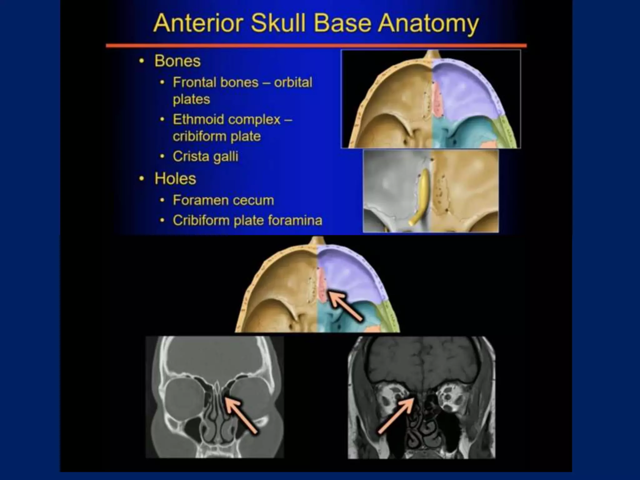 skull base lesion imaging.pptx