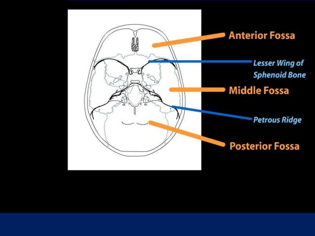 skull base lesion imaging.pptx | Ear, Nose and Throat Conditions | Diseases and Conditions