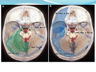 Skull base meningioma | PPTX