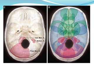 Skull base meningioma | PPTX