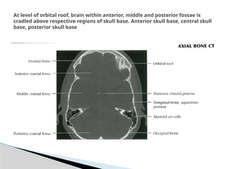 SKULL BASE OVERVIEW anatomy anteroir middle and posterior | PPT