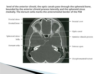 SKULL BASE OVERVIEW anatomy anteroir middle and posterior | PPT